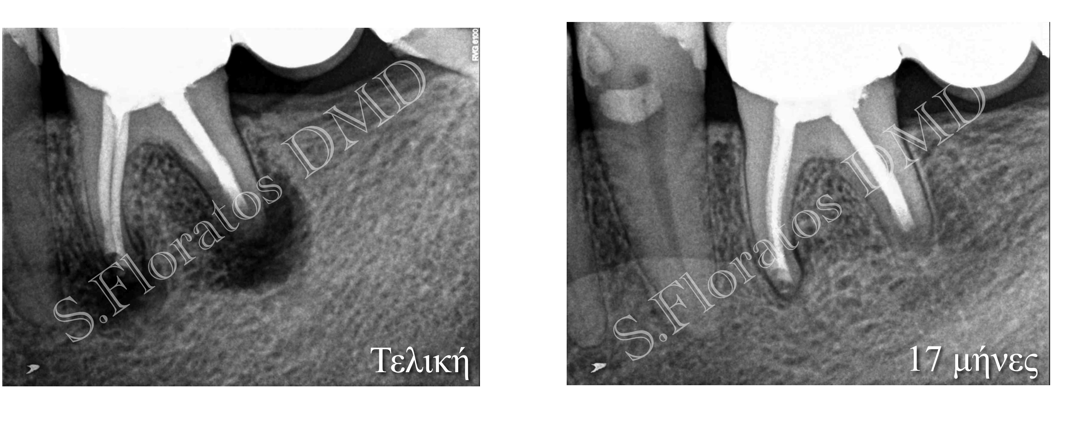Modern Microsurgery - Endodontics treatments / Root canal treatments ...