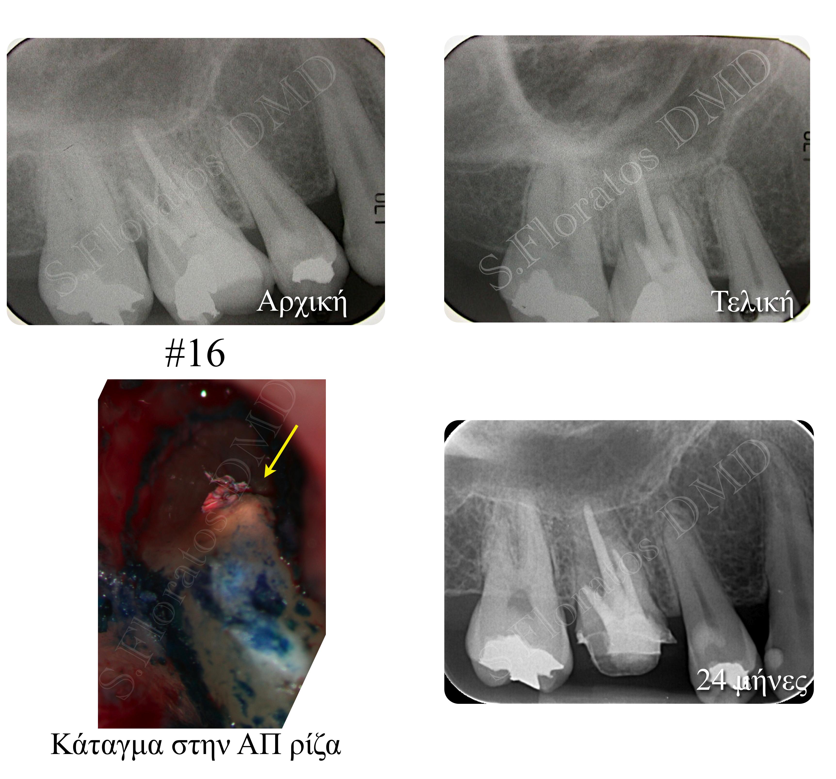 Modern Microsurgery - Endodontics treatments / Root canal treatments ...